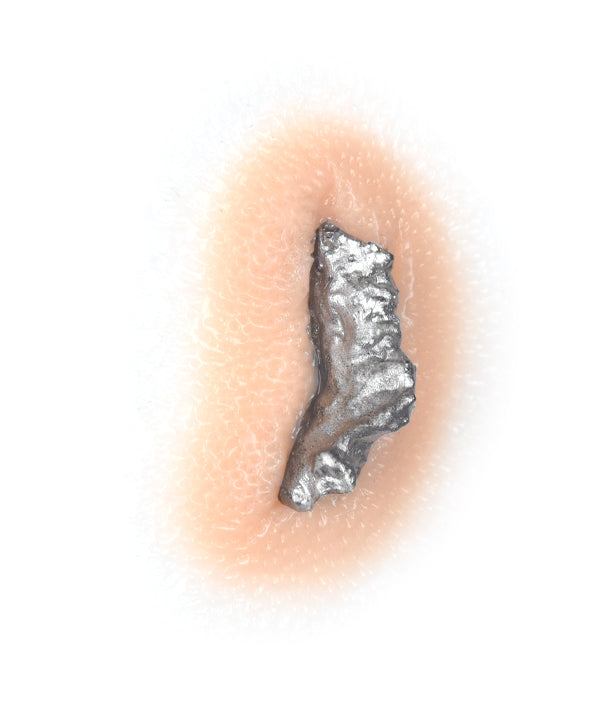 Metal Shrapnel Wound 5 – Out of Kit