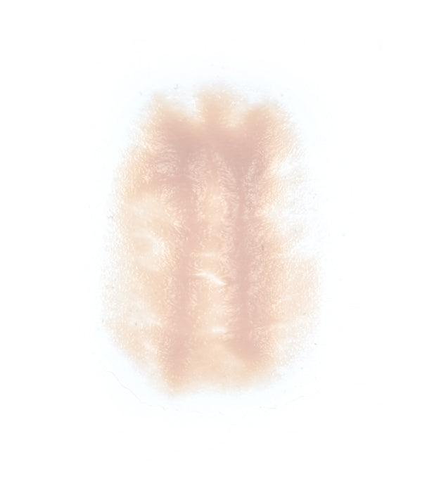 Female Neck Waddle 7 – Out of Kit